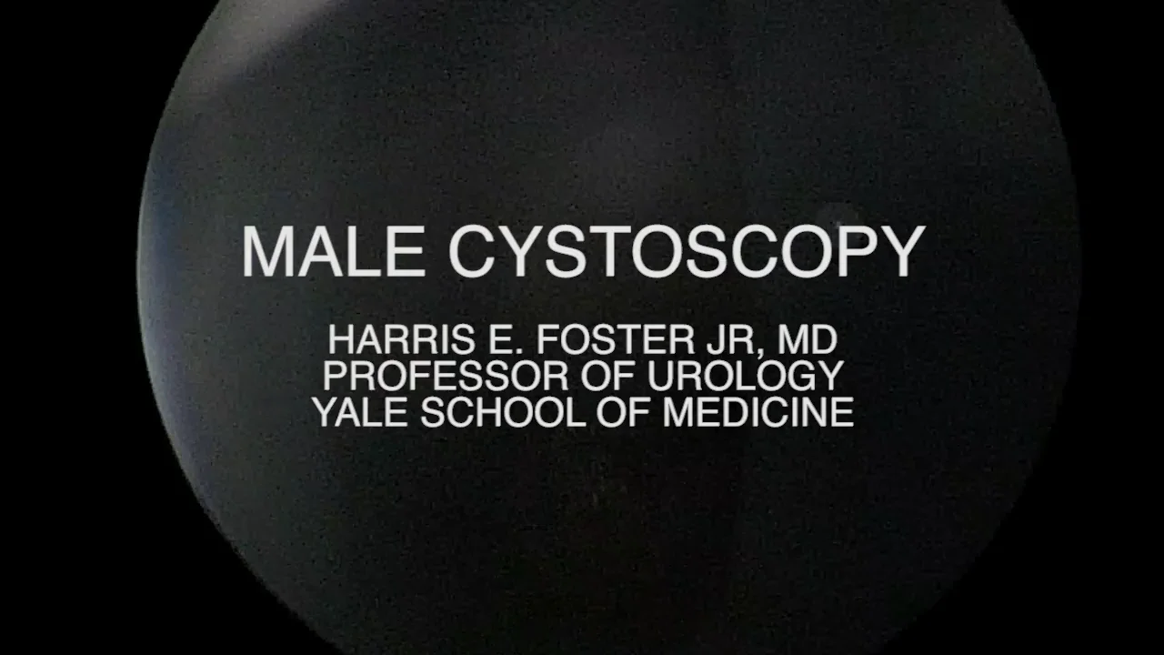 Male Cystoscopy
