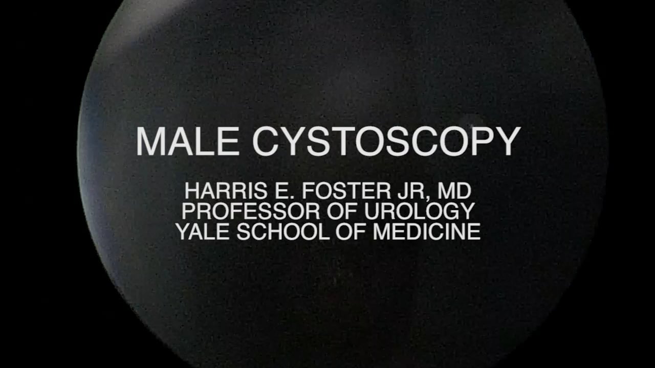 Male Cystoscopy