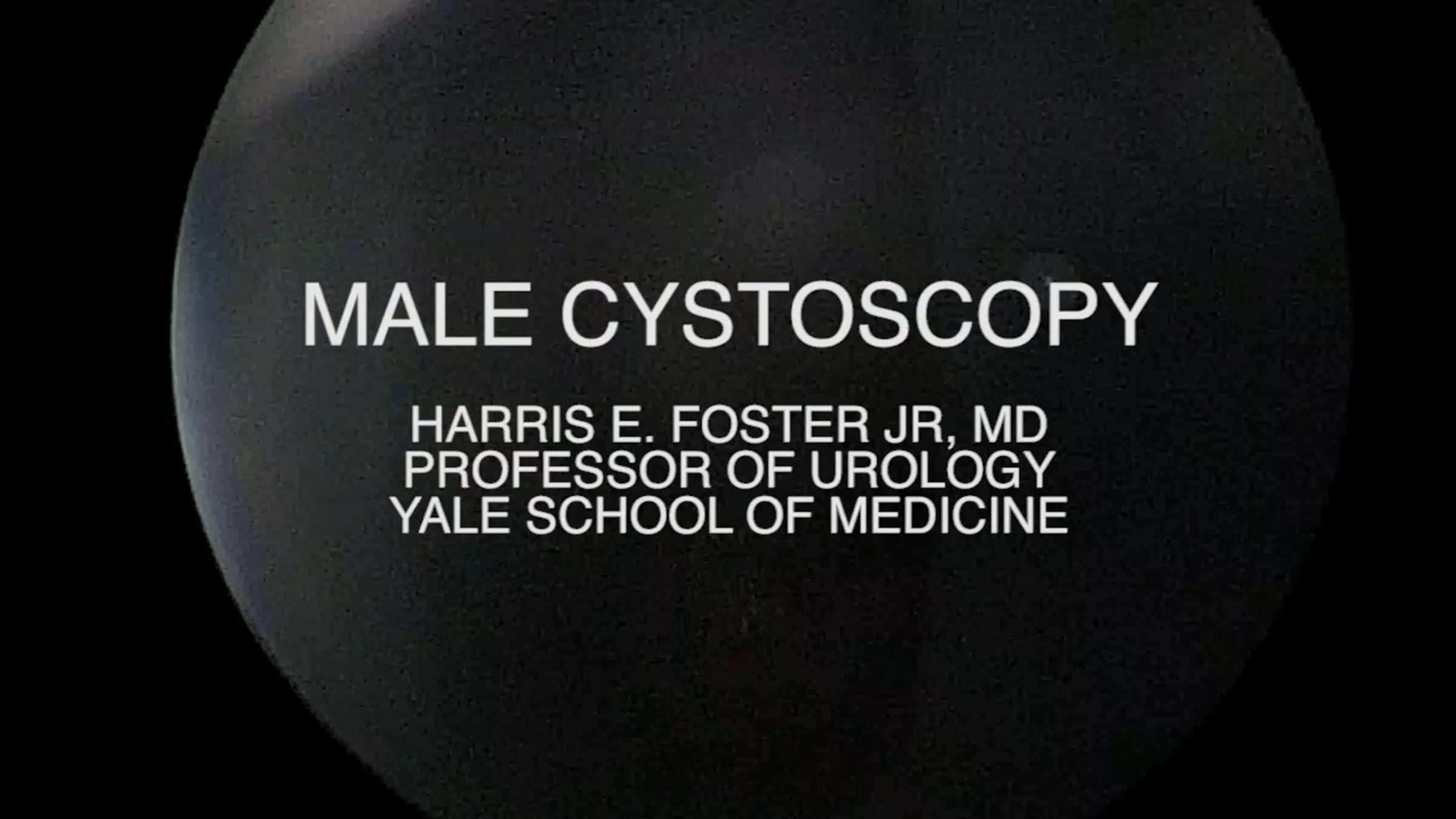 Male Cystoscopy