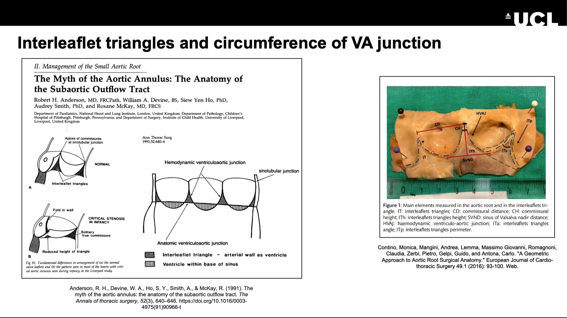 Striving for physiologic coaptation: An experimental and innovative ...