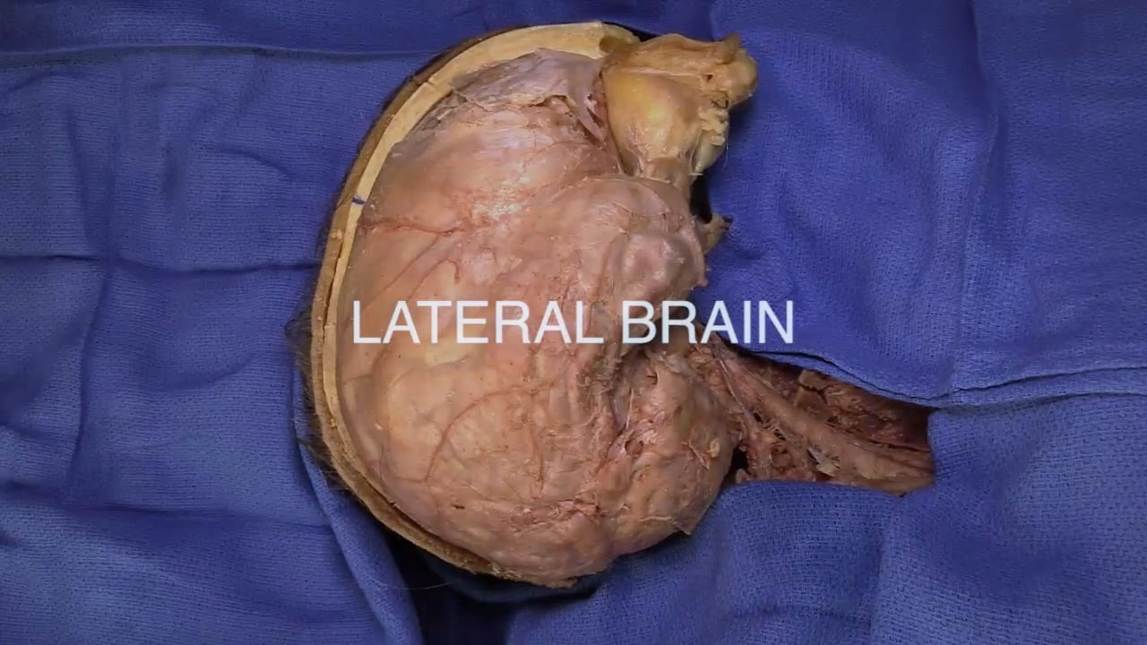Lateral Brain