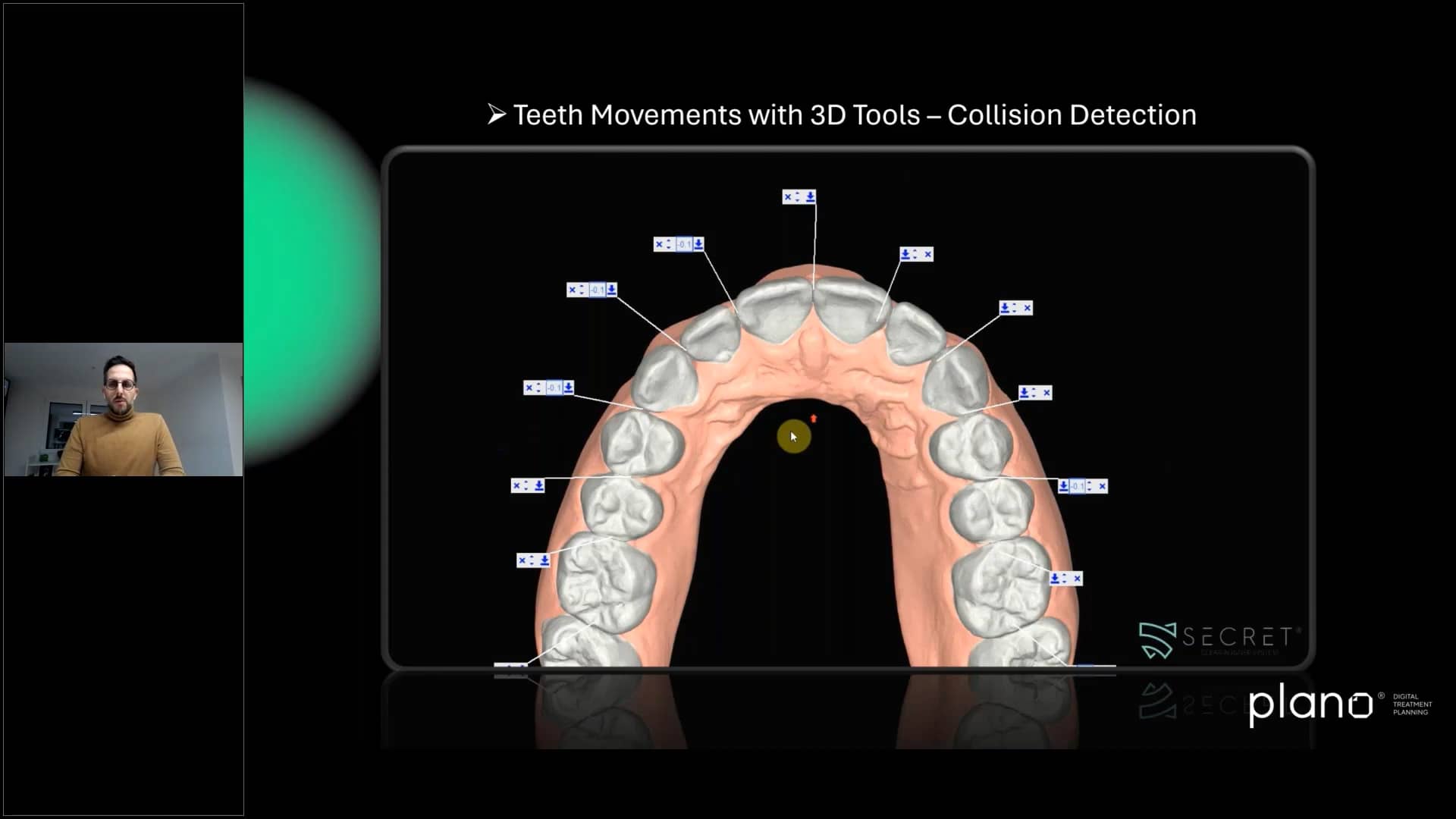 Webinar Orthodontics. Advanced In-House Aligner Course inDigital Treatment Planning. Dr. Fragkos ...