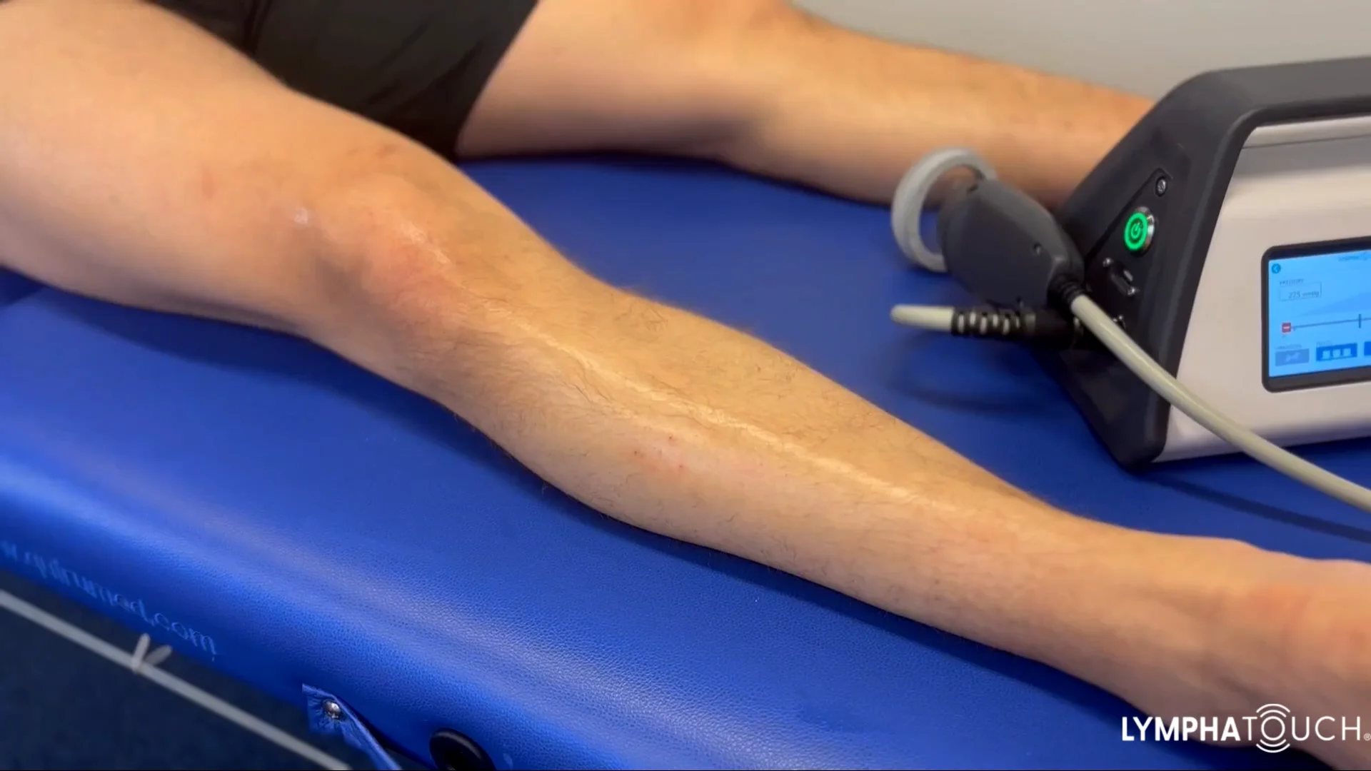 LymphaTouch Pro edema treatment step 8 on Vimeo
