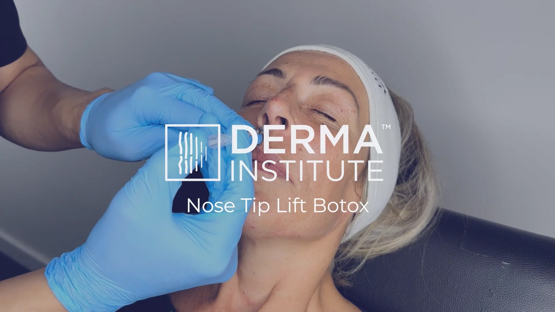 Nose Tip Lift Botox