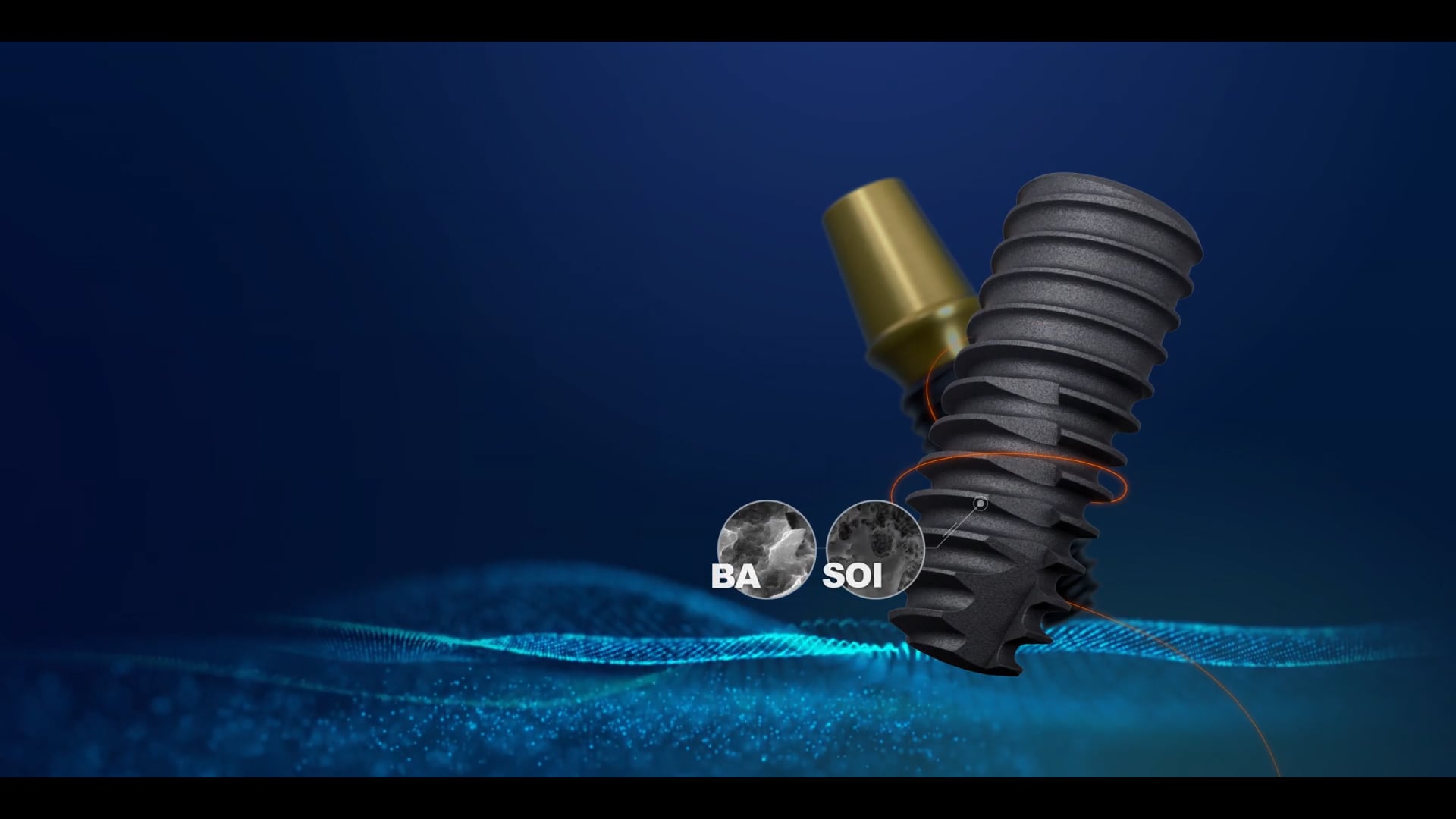 Implant