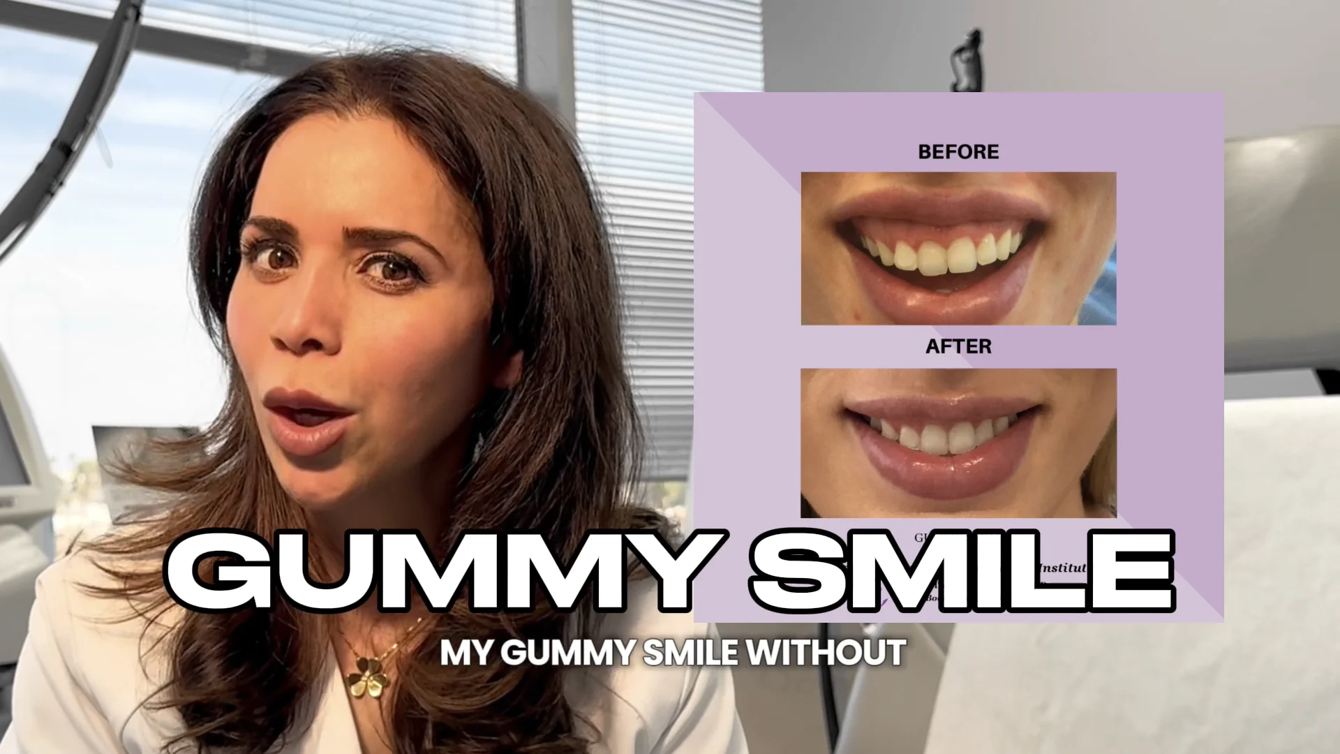Gummy Smile | Dr. Tanya Kormeili on Vimeo