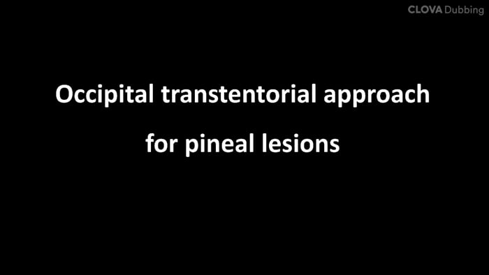Occipital transtentorial approach for pineal lesions - ISPN Library