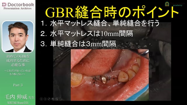 専門医はこうする！！～GBR法の実際～ part2 #3 | Doctorbook academy (ドクターブックアカデミー)