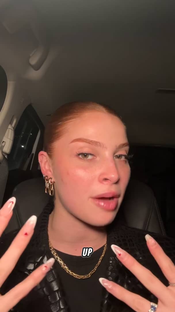 ACNEA: Chanse’s AMAZING acne transformation on Vimeo