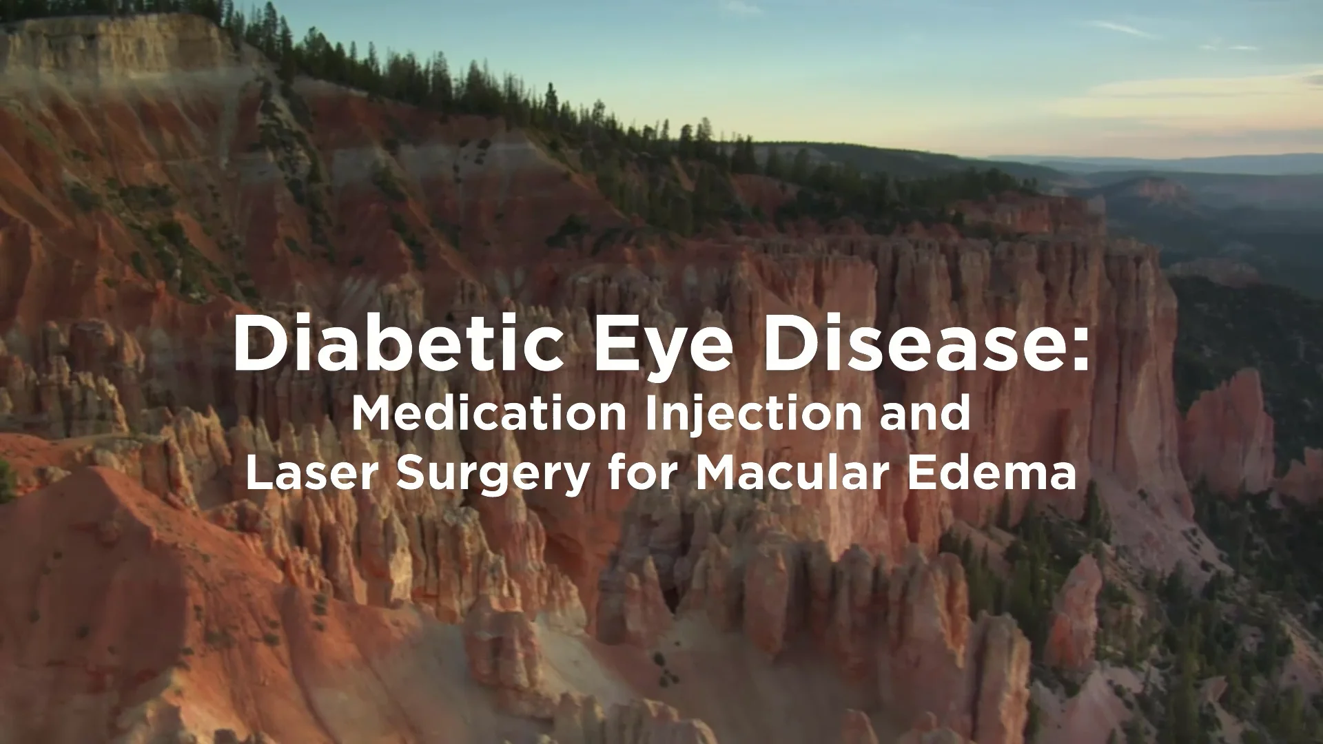 Medication Injection and Laser Surgery for Macular Edema on Vimeo