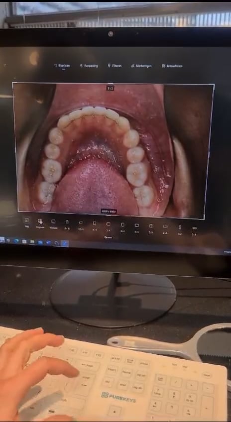Instructie-foto's-bewerken-deel 2