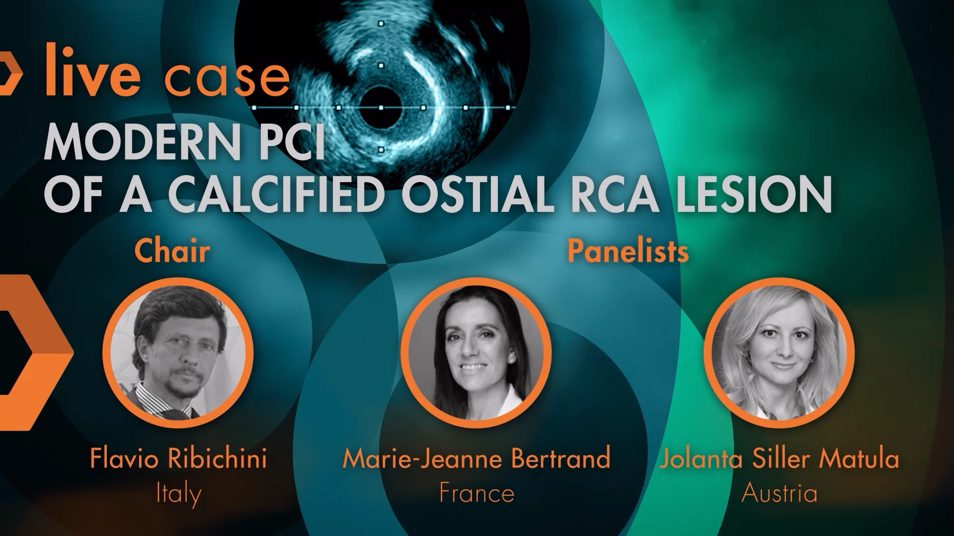 School of Rock Case #7: Live treatment of a calcified Ostial RCA PCI: a ...