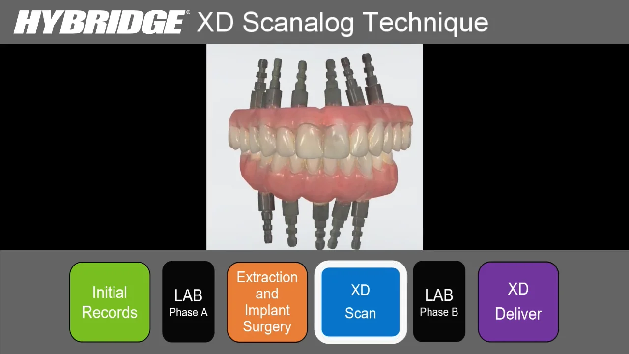 Frank Conversations - Scanalog Technique Protocol on Vimeo