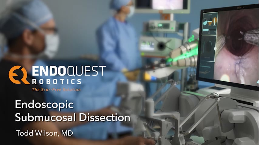 EndoQuest Robotics: Endoscopic Submucosal Dissection, with Todd Wilson MD