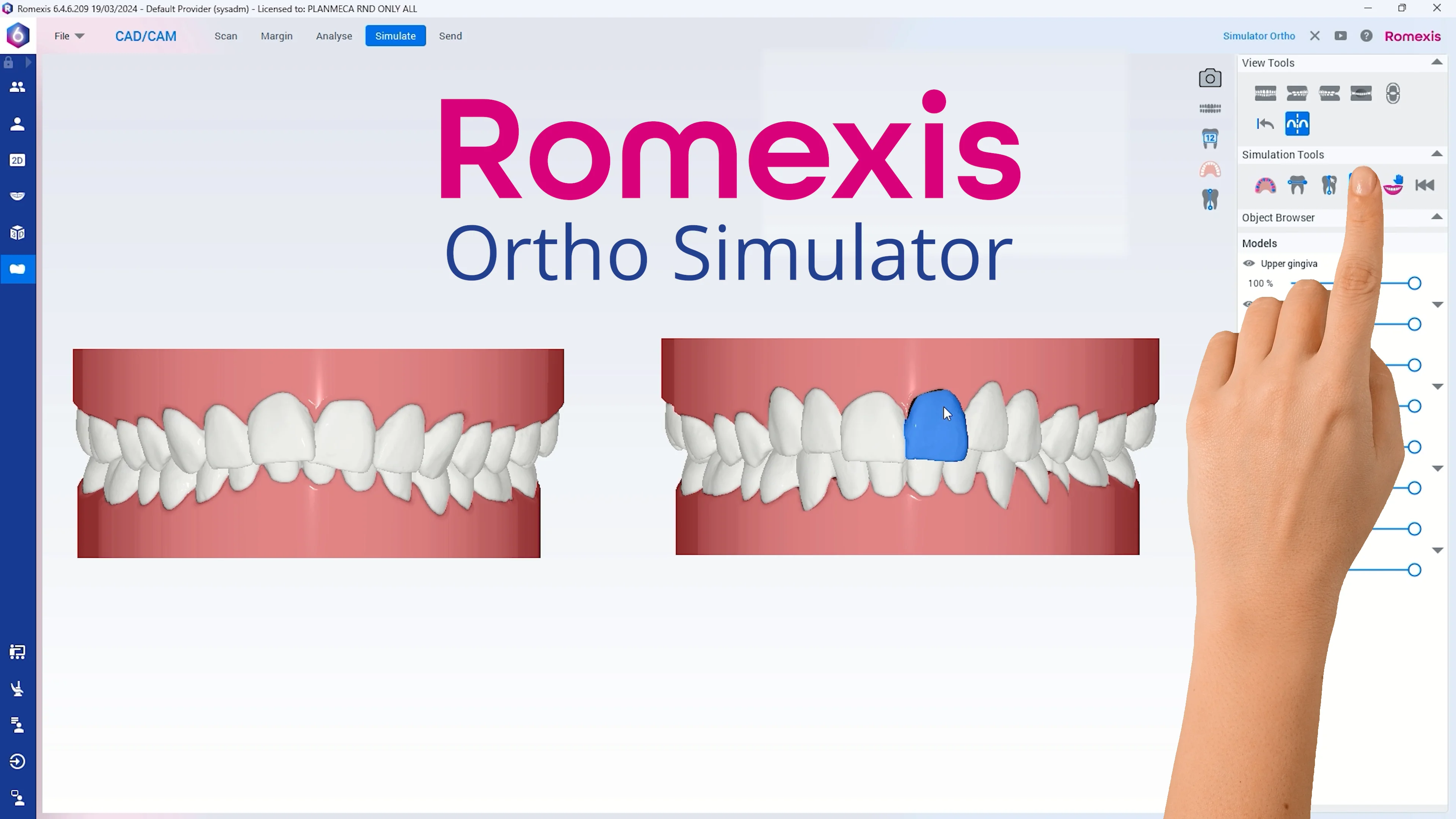 Planmeca Romexis® Ortho Simulator