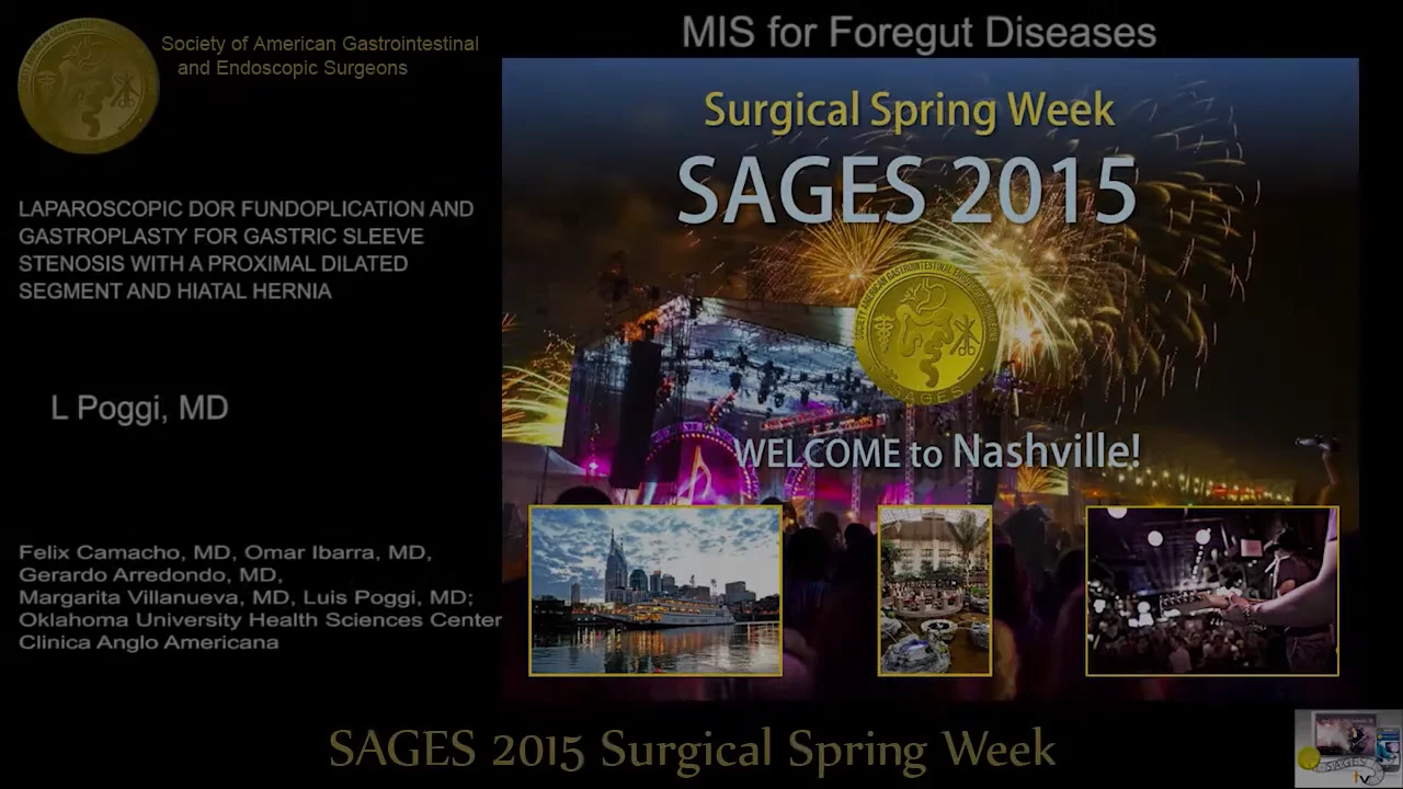 LAPAROSCOPIC DOR FUNDOPLICATION AND GASTROPLASTY FOR GASTRIC SLEEVE ...