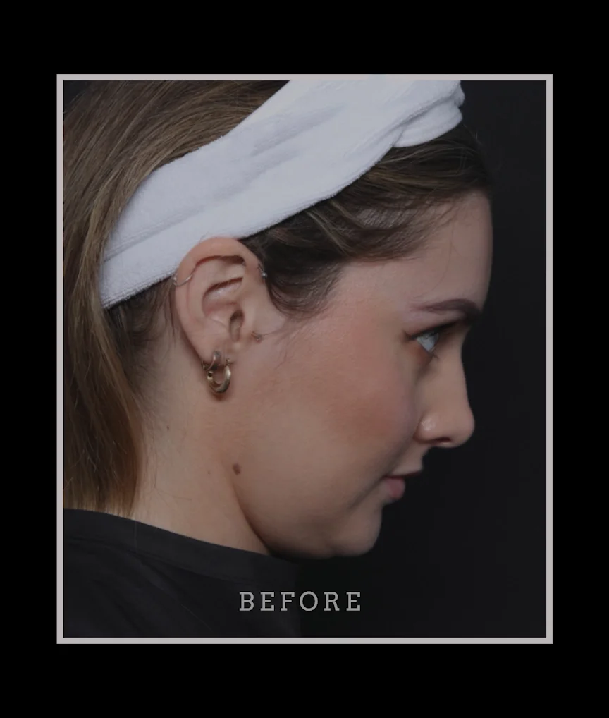 7 point shape 3 before afters4 on Vimeo