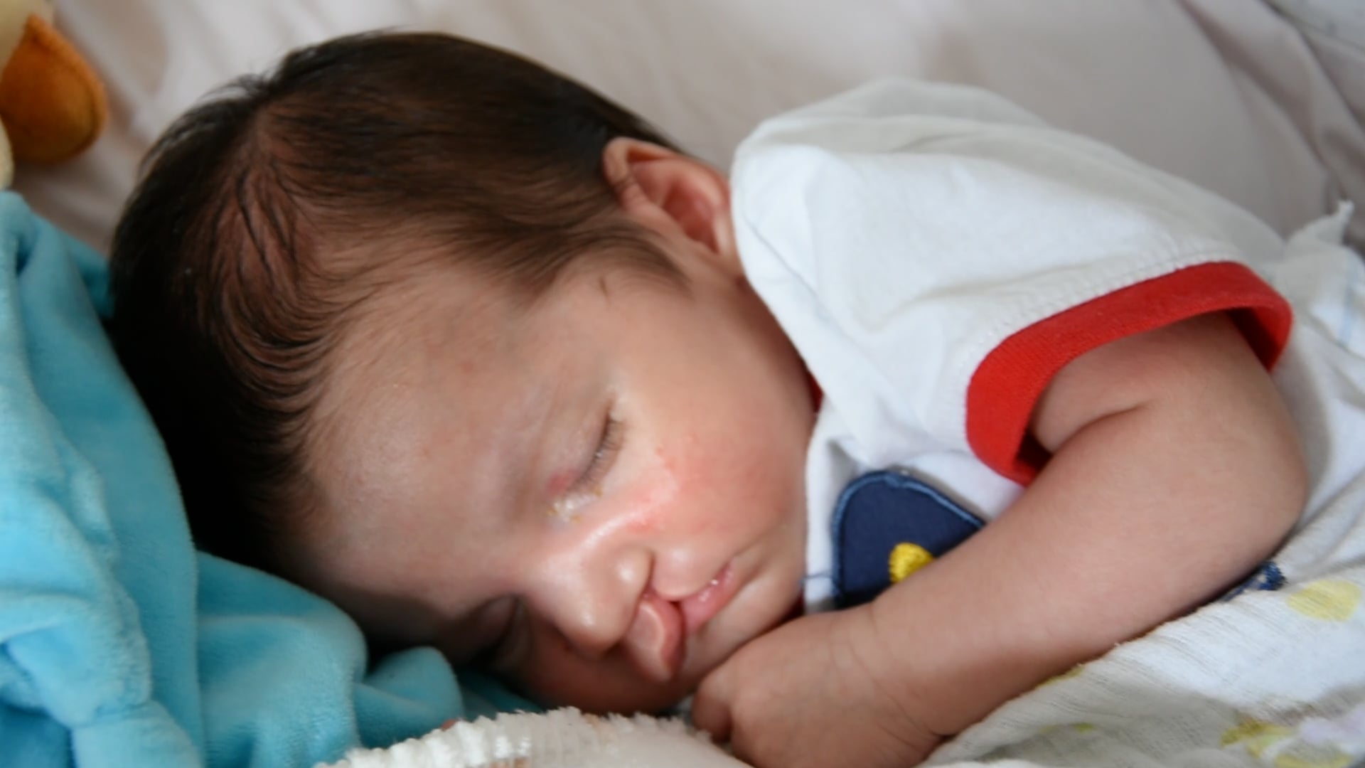 Support Cleft Lip Warriors - Smile Charity