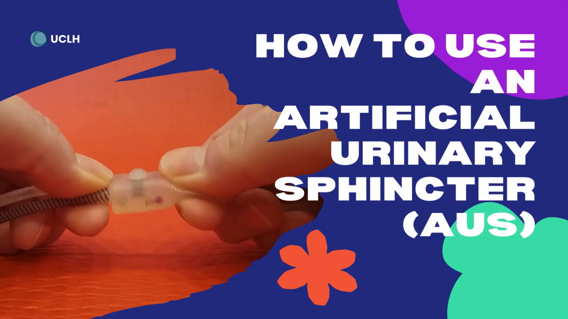 How to use artificial urinary sphincter (AUS) (subtitles) on Vimeo