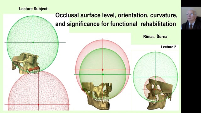 Spherical Occlusion Theory: for Dentists and Dental Technician Team