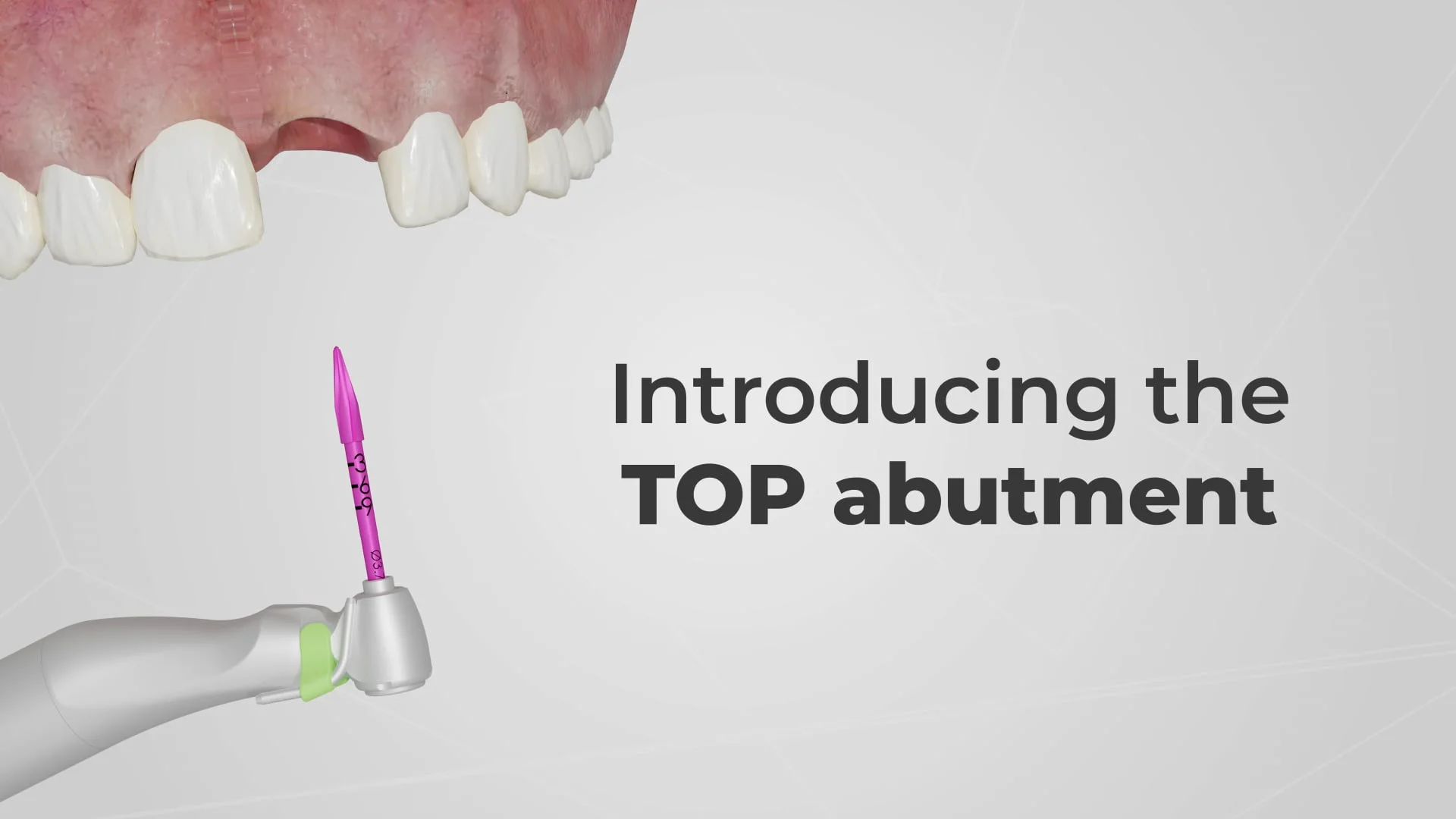 Introducing the TOP Abutment on Vimeo