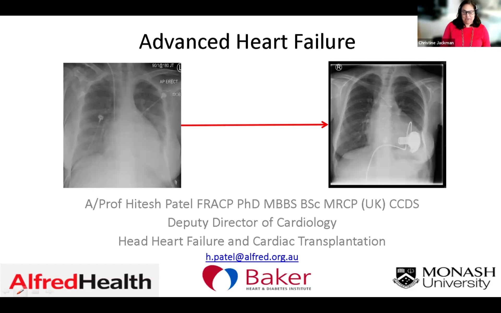 Epworth Grand Rounds Videos - Epworth Grand Rounds 07/05/2024: Advanced ...
