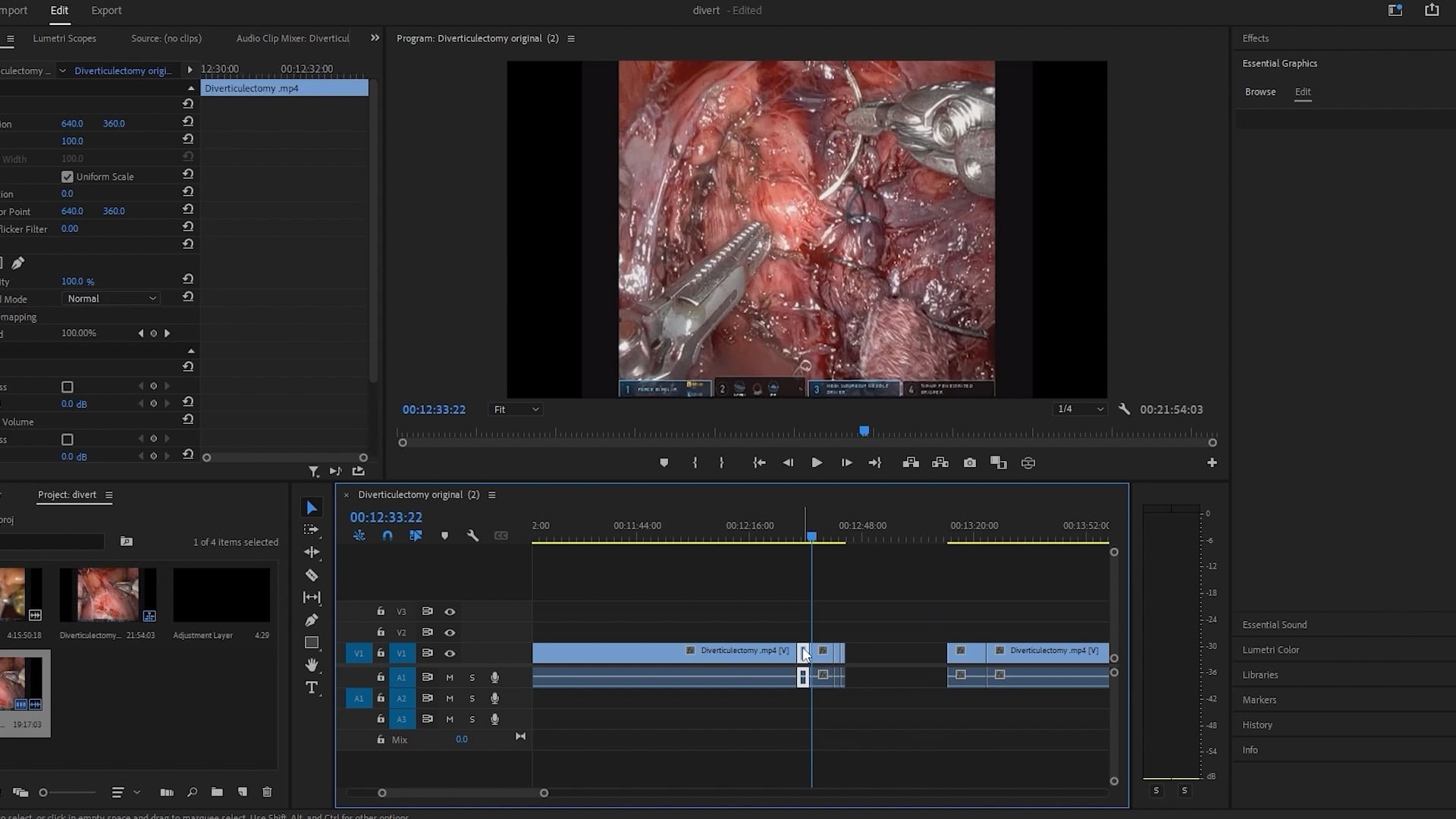 How to edit a surgical case video | MMCTS