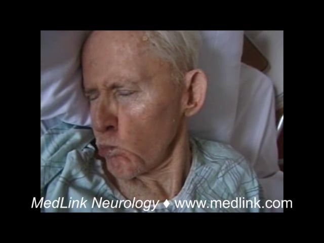 Stereotypies | MedLink Neurology