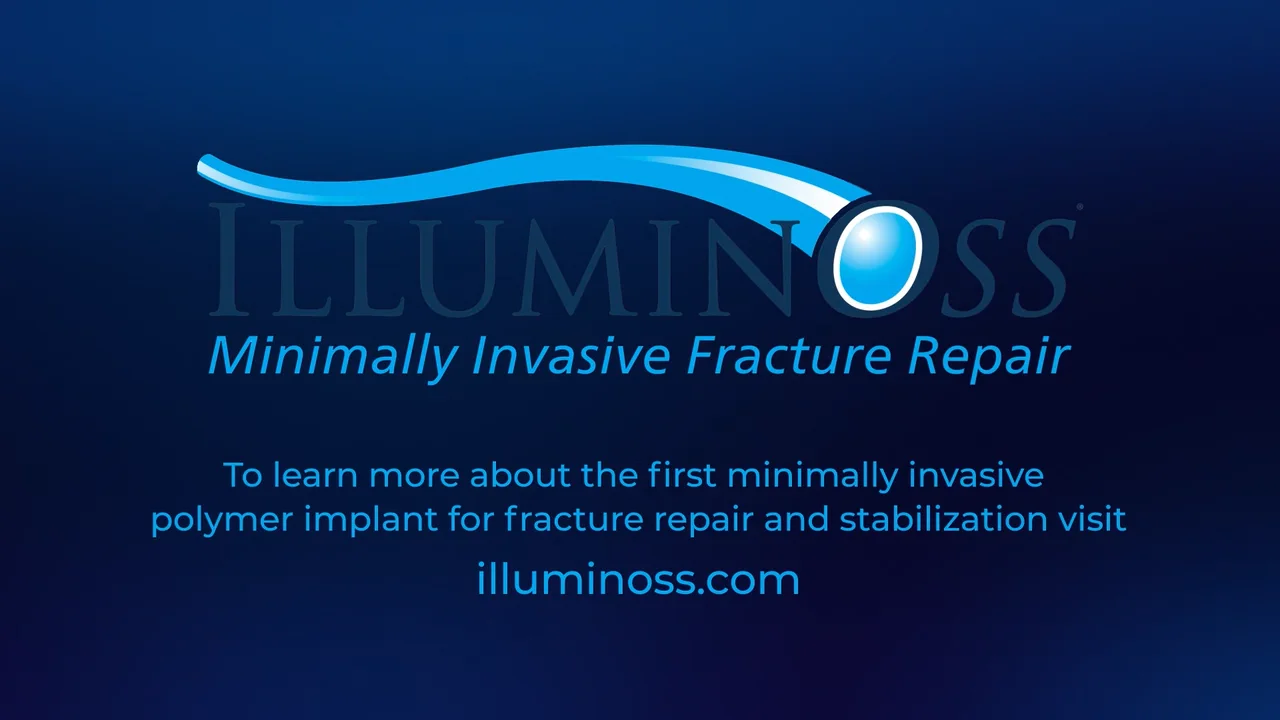 IlluminOss, The Next Generation in Orthopedic Technology on Vimeo
