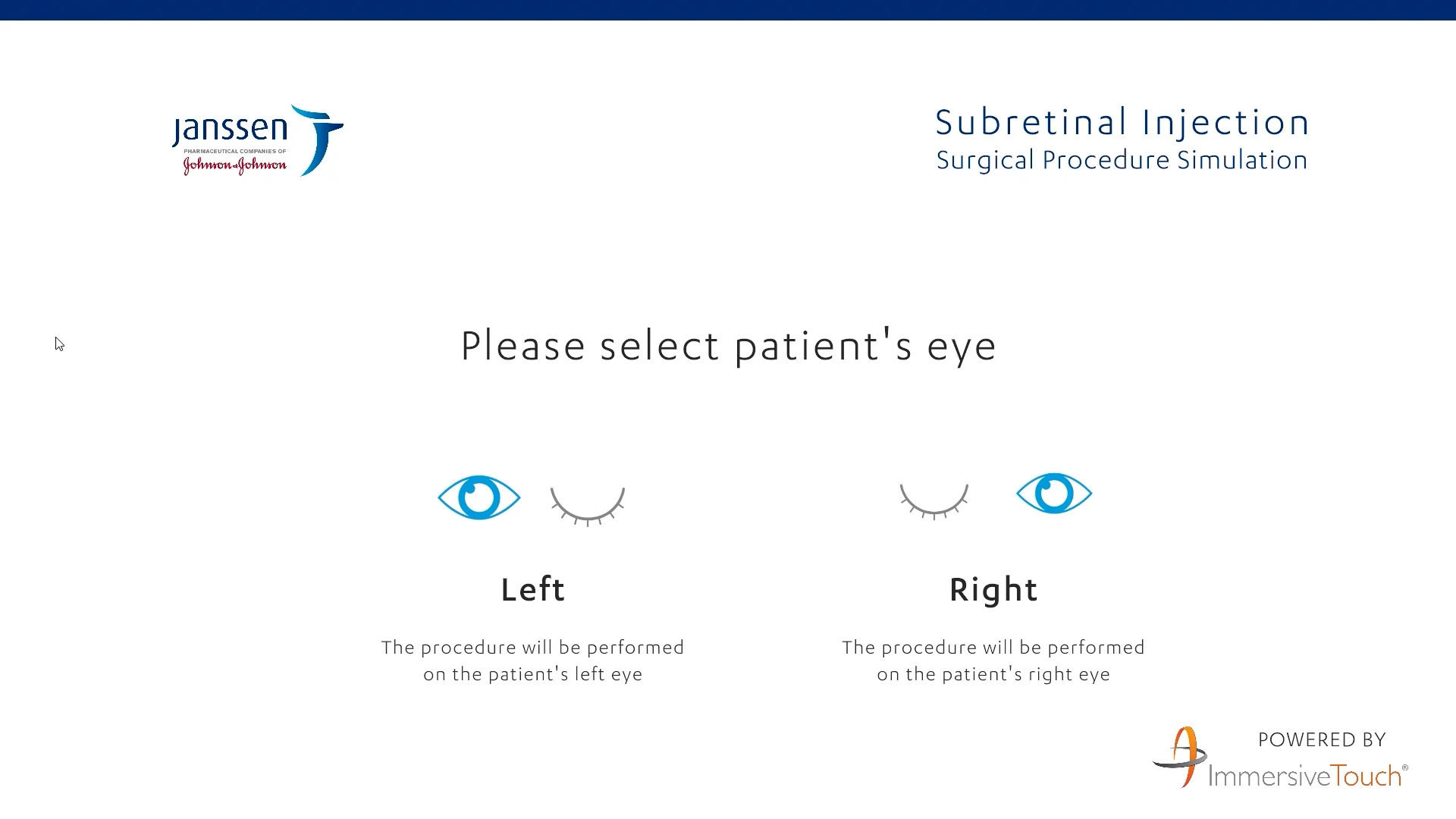 Custom Simulation Product Overview
