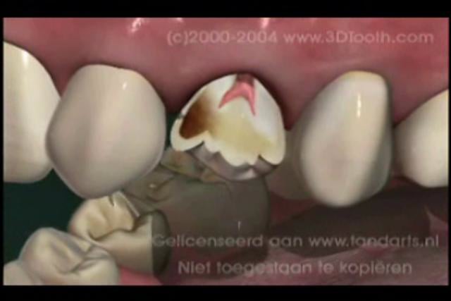 Tandbederf on Vimeo