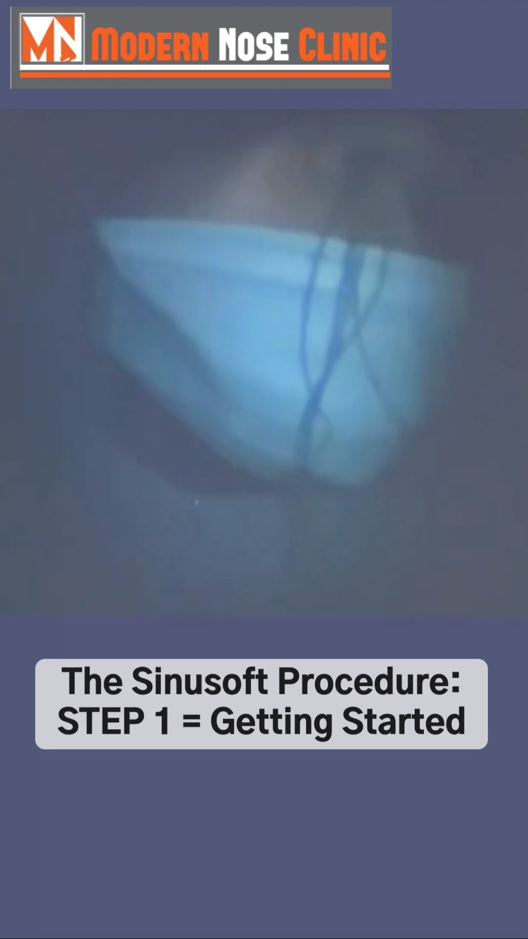 Sinusoft Procedure: How we make you comfortable #1