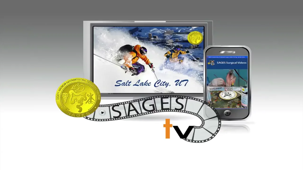 Laparoscopic Paraesophageal Hernia with Falciform Ligament Buttress on ...