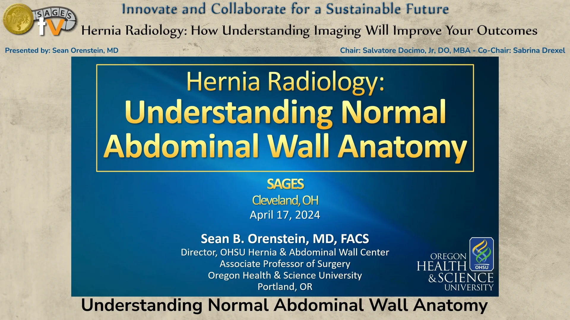 Understanding Normal Abdominal Wall Anatomy