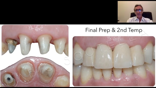 OHI-S Dental portal