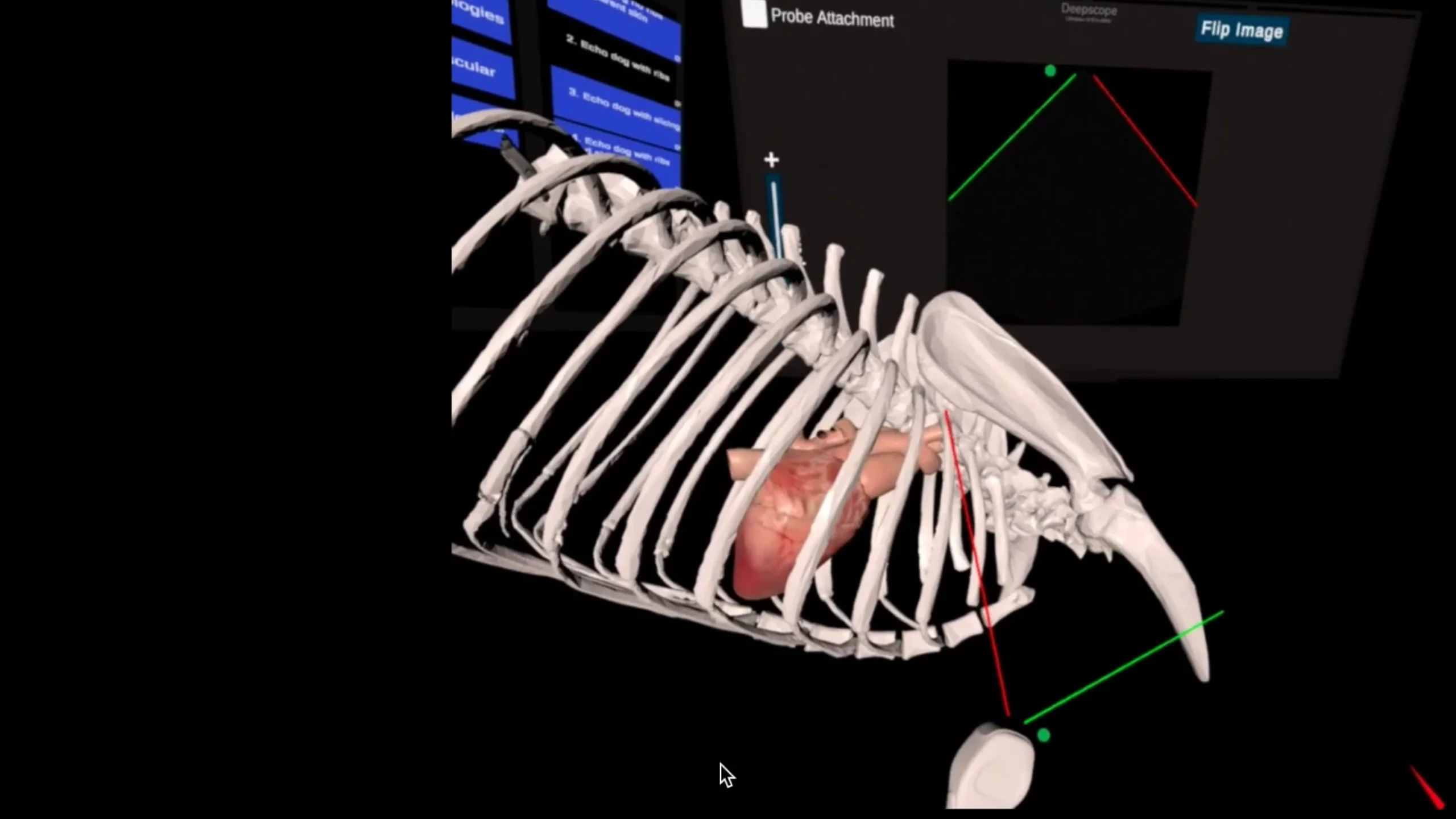 00 Virtual reality short axis cardiac demo (deepscope)