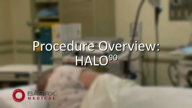Procedure Overview HALO 90