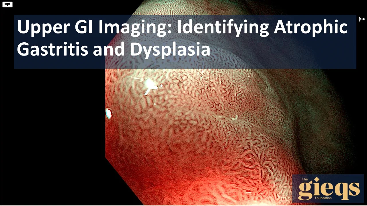 Upper GI Imaging: Identifying Atrophic Gastritis and Dysplasia on Vimeo