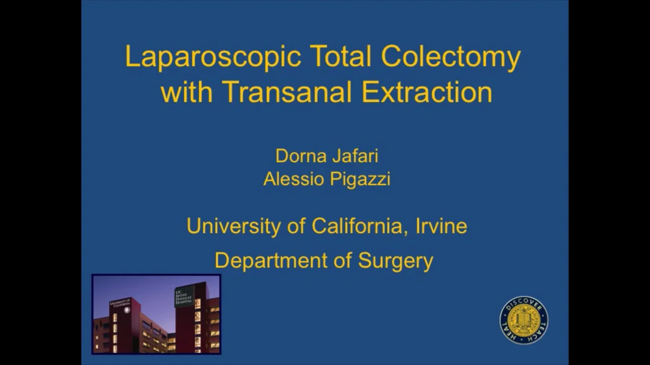 Laparoscopic Total Colectomy With Trans-Anal Extraction on Vimeo