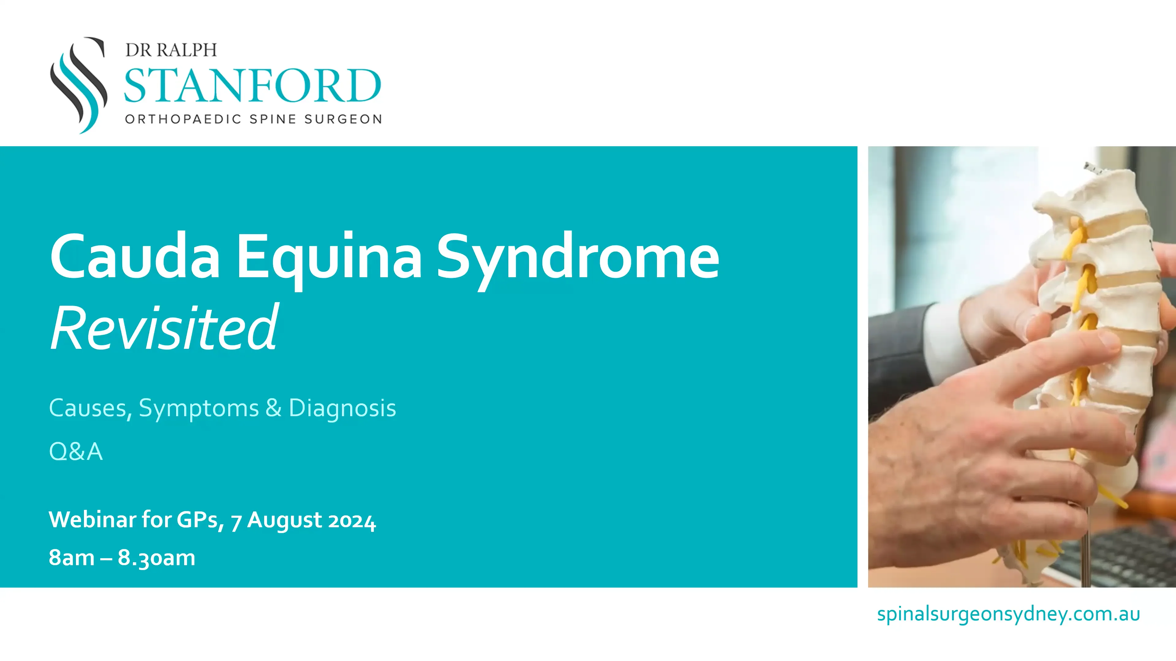 Causes Of Cauda Equina Syndrome What Is The Diagnostic Accuracy Of Red