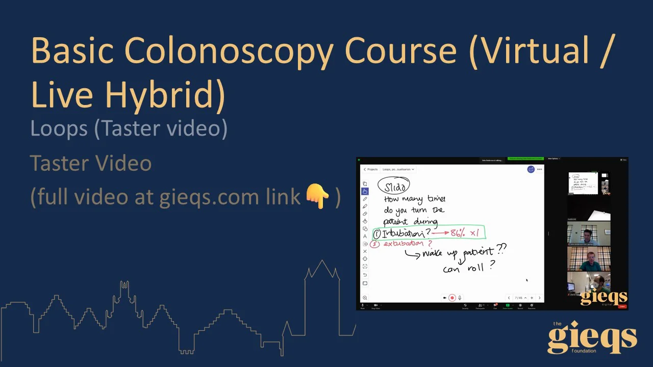 Loops (Taster video) on Vimeo
