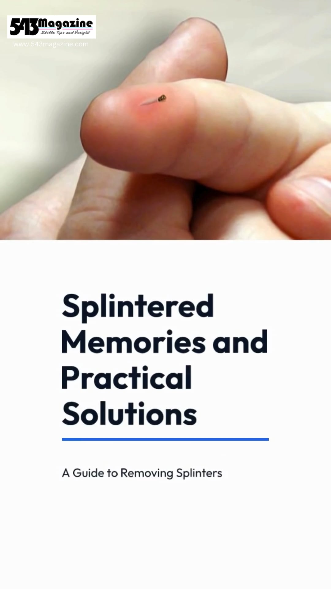 A Guide to Removing Splinters 543magazine