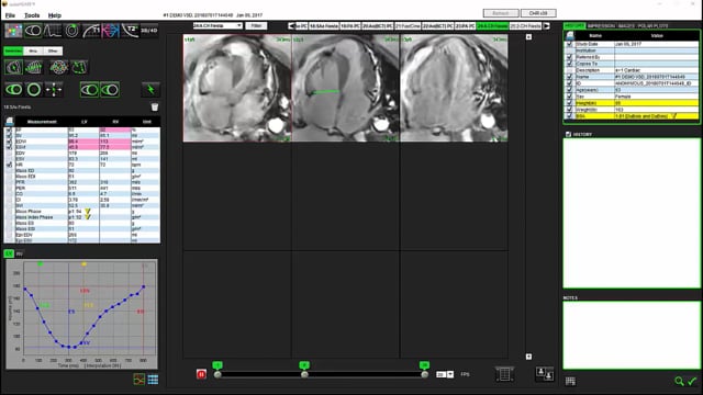 Video Lectures Archive - Cardiac MRI