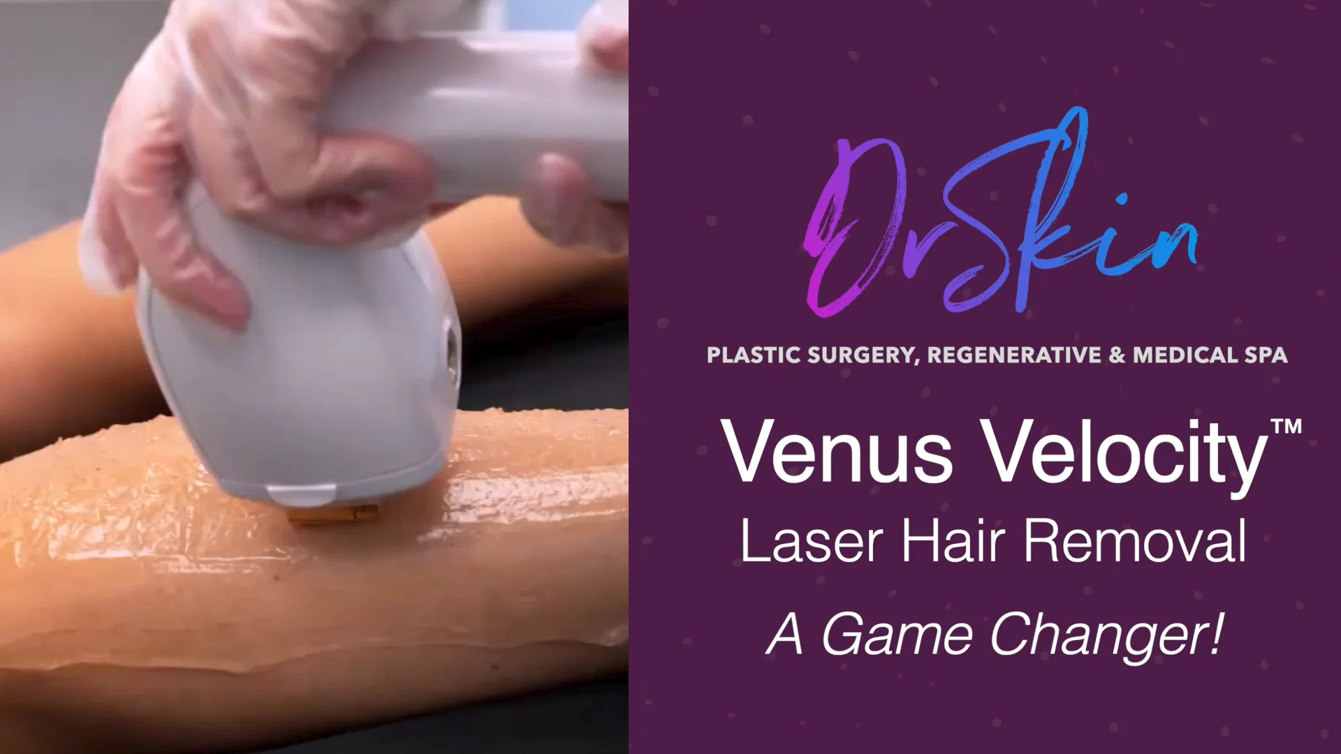 Patient Education - Venus Velocity Laser