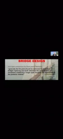fixed movable bridge: key consideration for optimal use