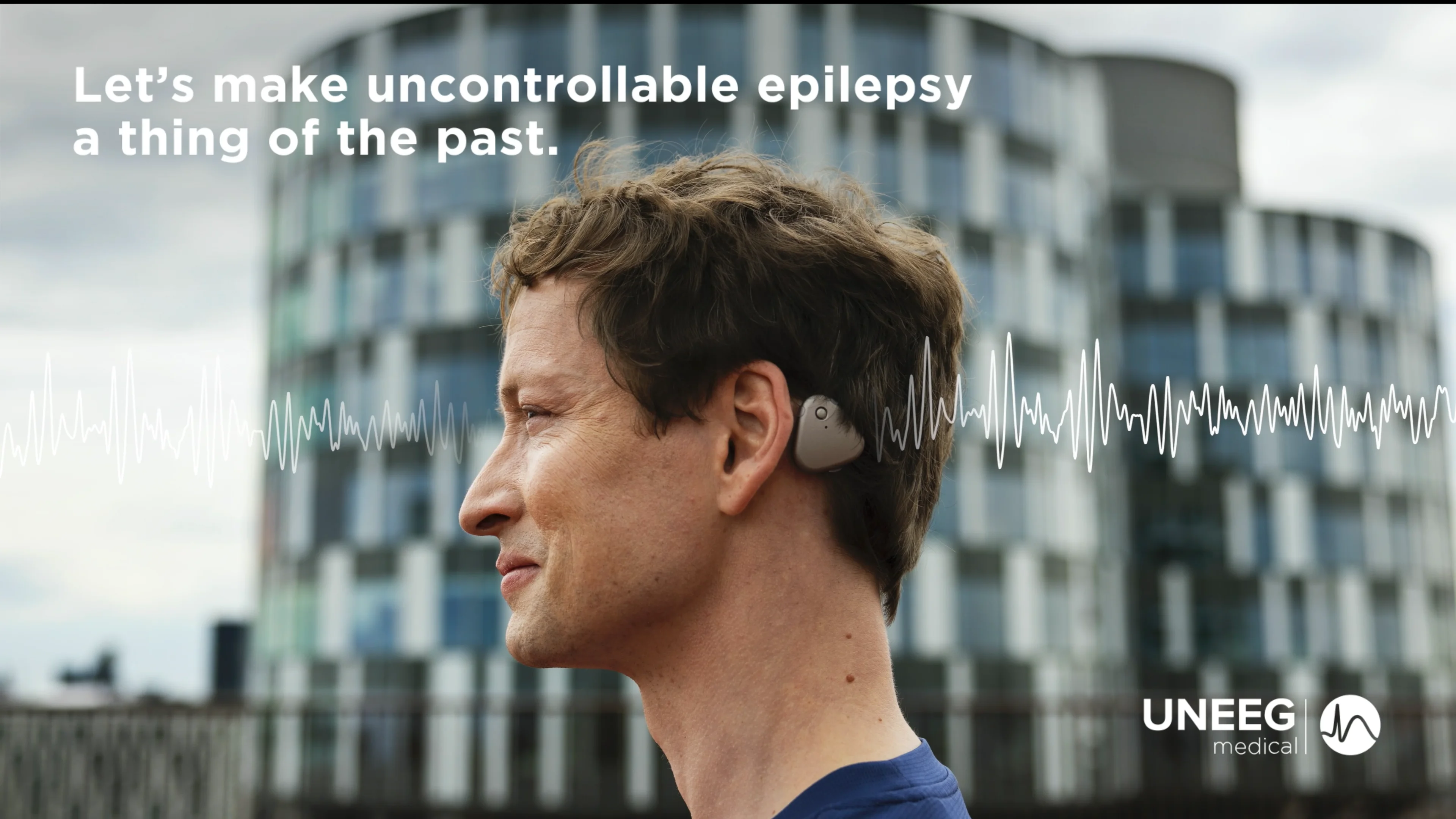 UNEEG EpiSight: real-life ultra long-term EEG recording