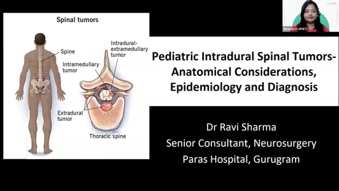 Pediatric Intradural Spinal Tumors - Anatomical Considerations ...