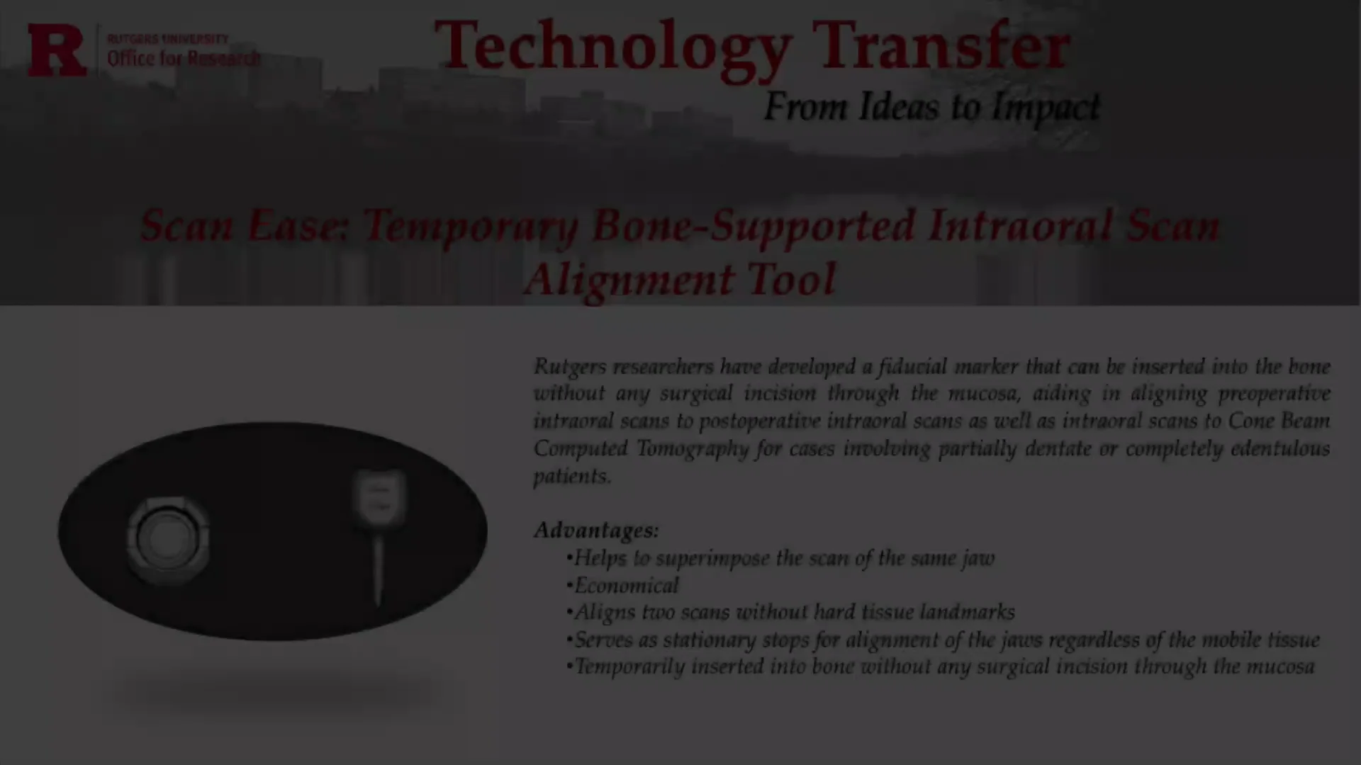 Scan Ease: Temporary Bone-Supported Intraoral Scan Alignment Tool