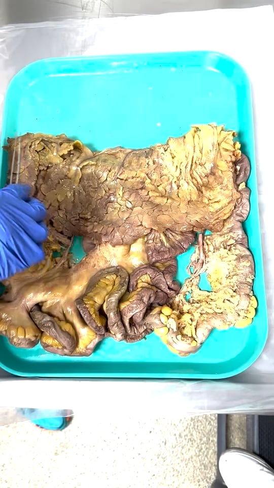 SMA, IMA, and hepatic portal system