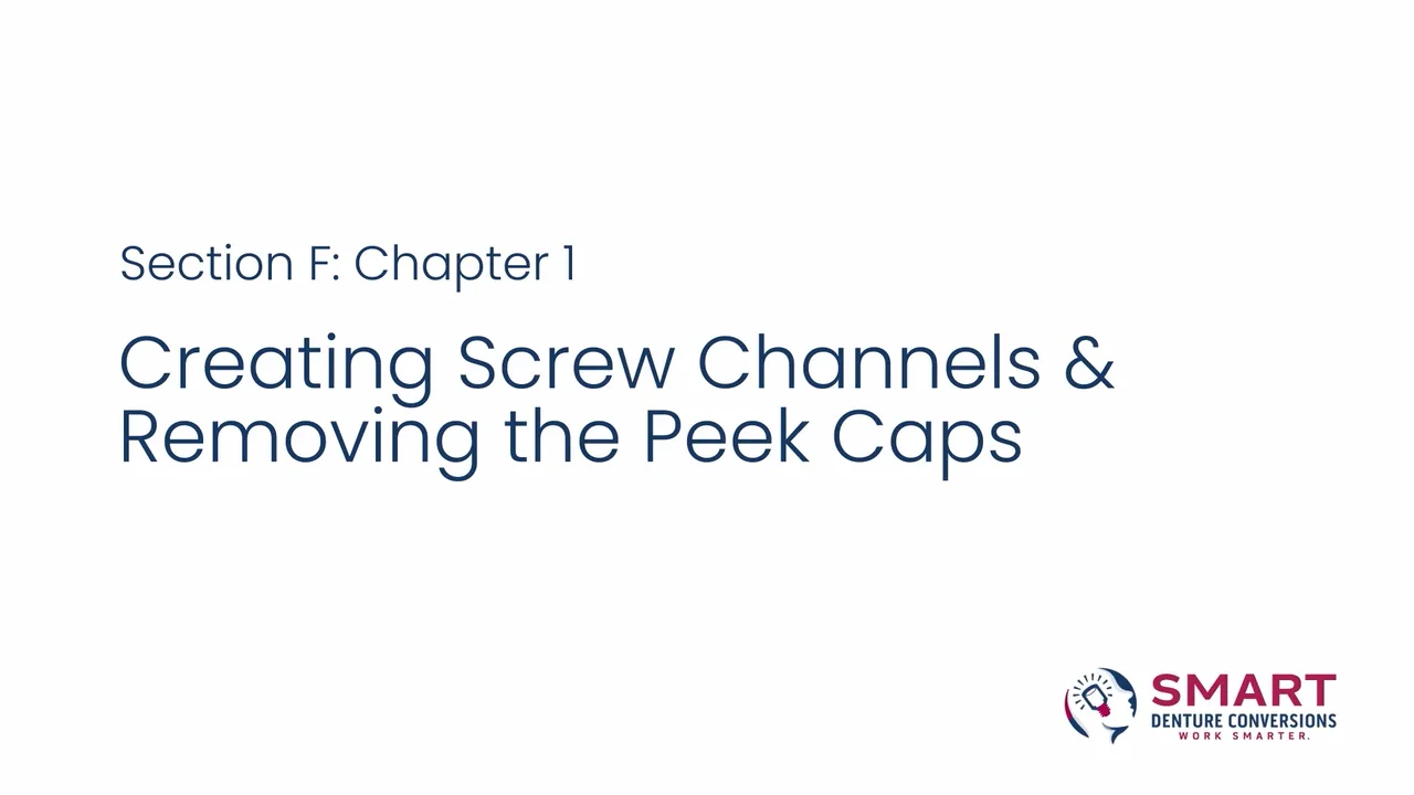 Screw Channel Access - Create Screw Channels and Remove PEEK Cap